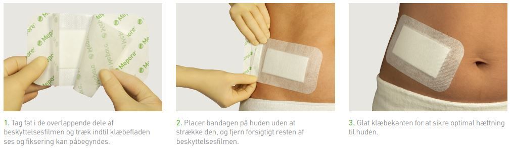 Kjøp Mepore plaster steril billig hos Med24.no